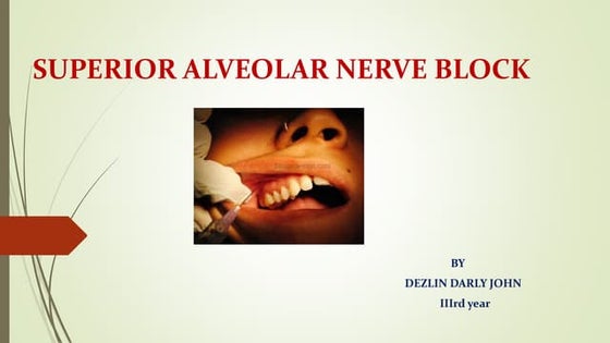 Mandibular Anesthesia : Inferior alveolar nerve block | PPT