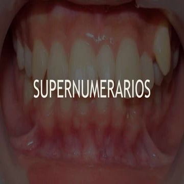 supernumerarios.pptx