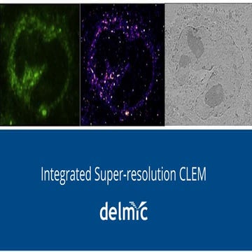 Superresolution Correlative Light and Electron Microscopy - DELMIC | PDF