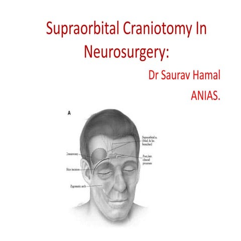 Pterional craniotomy | PPTX