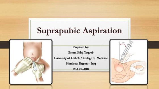 Appendix Removal Surgery In Bangalore | Laparoscopic Appendicitis Surgery In India | PPT