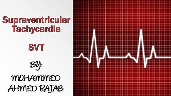 J POINT IN ECG AND ITS INERPRETATION IN ECG | PPTX