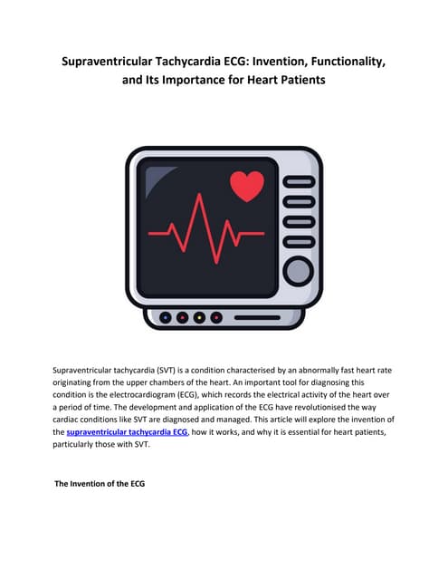 What Are the Key ECG Findings in Supraventricular Tachycardia? | PDF