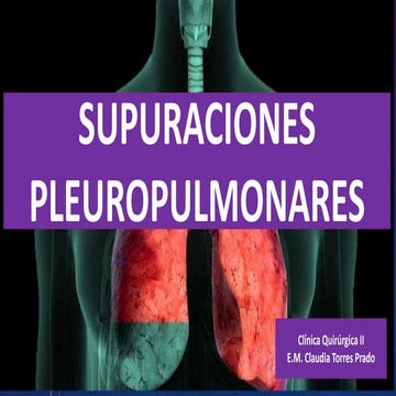Supuraciones pleuropulmonares | PPTX