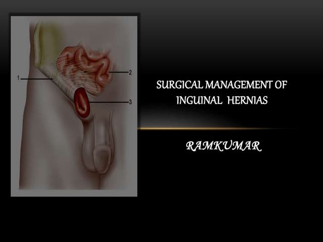 Obstructed & stragulated hernia1 | PPTX