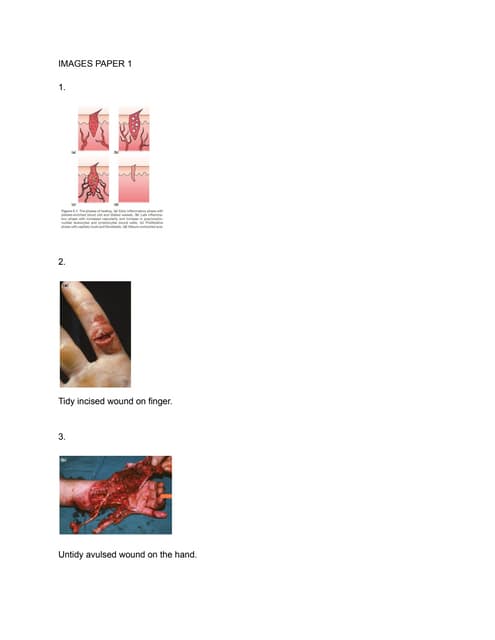 SURGERY MCQs(1).pdf