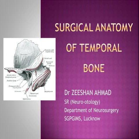 Temporal Bone Anatomy Ppt