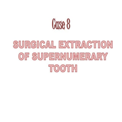 Surgical extraction of suprnumeraray tooth. | PPT