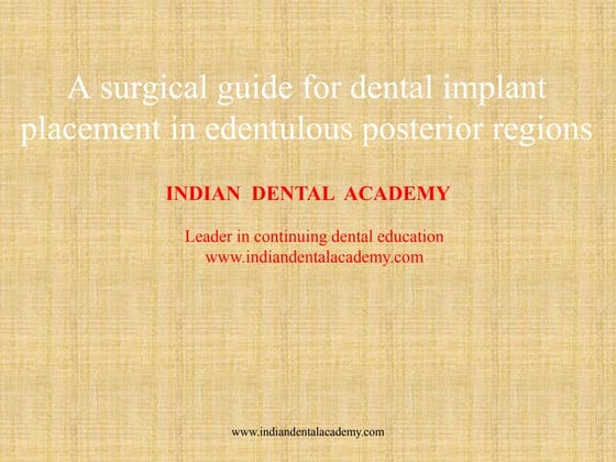 Implant structure, components, and surface modification | PPT