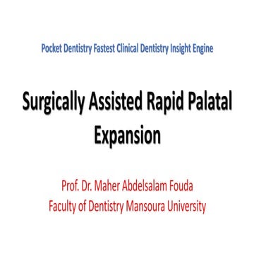 Surgically Assisted Rapid Palatal Expansion (SARPE) | PPTX