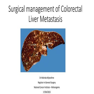 Surgical management of Colorectal Liver Metastasis.pptx