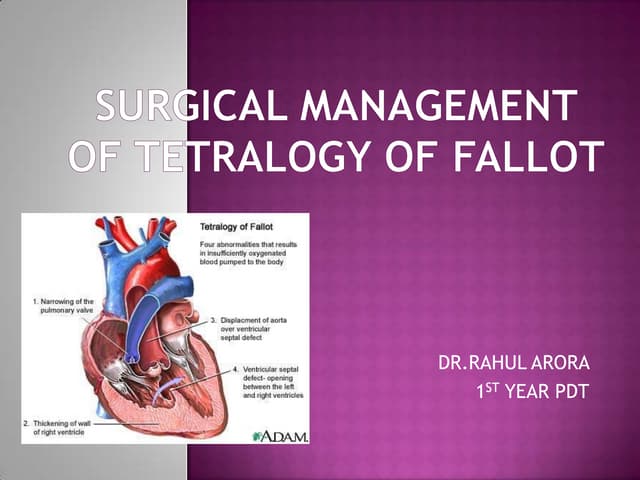 Journal Review Revert Trial Modified Valsalva For Supraventricular