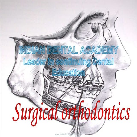 Canine retraction | PPT