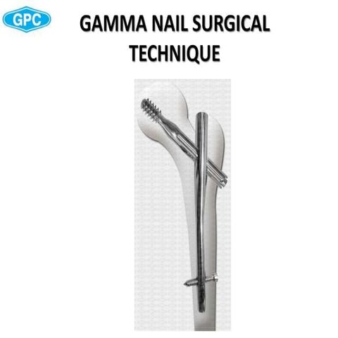 Surgical technique for gama nail | PPTX