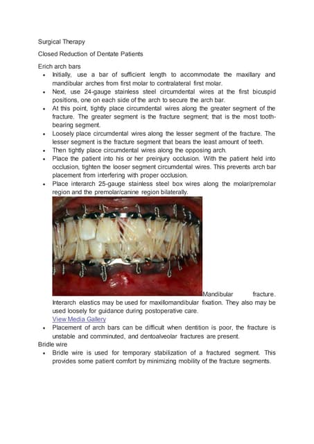 LARS ACJ Surgical Technique Corin Lennard Funk | PDF