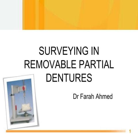 removable partial denture survey lines, path of insertion, guide planes ...