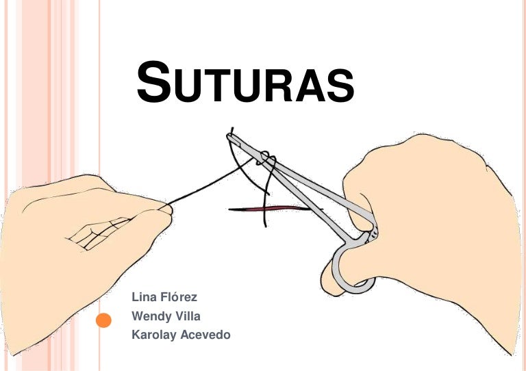 Suturas