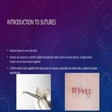 SUTURES: INTRODUCTION, TYPES AND USES.pptx
