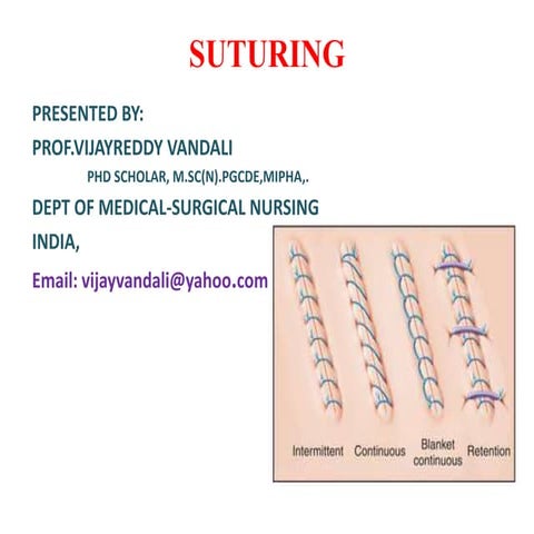 Suturing | PPTX