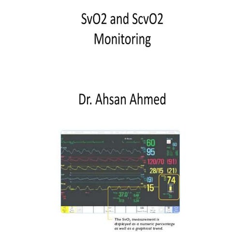 SvO2 & ScvO2 monitoring | PPTX