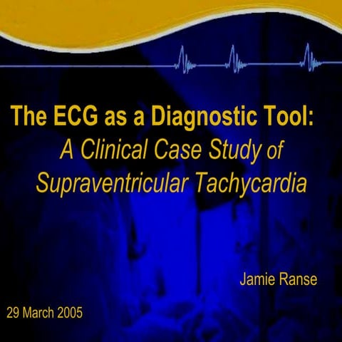 The ECG as a Diagnostic Tool: A Clinical Case Study of Supraventricular ...