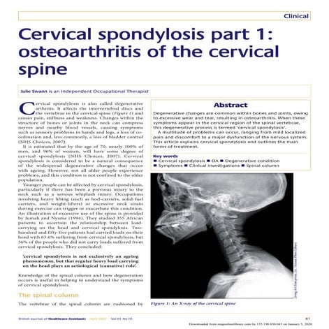 Cervical Spondylosis - An Overview of Degenerative Cervical Spine ...
