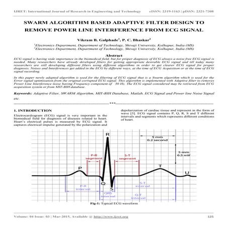 Artifact Elimination In Ecg Signal Using Wavelet Transform