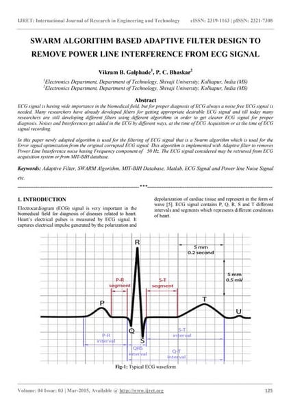 Artifact Elimination In Ecg Signal Using Wavelet Transform