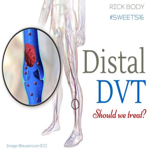 Distal DVT: Should we treat? | PPTX