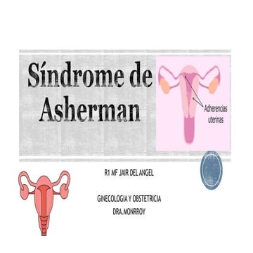 sx asherman.pptx