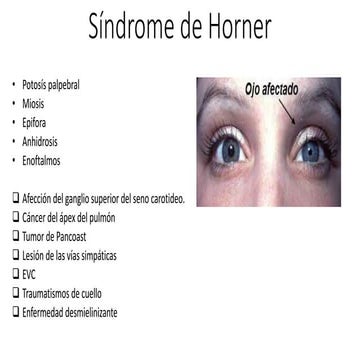Sx de horner | PPT