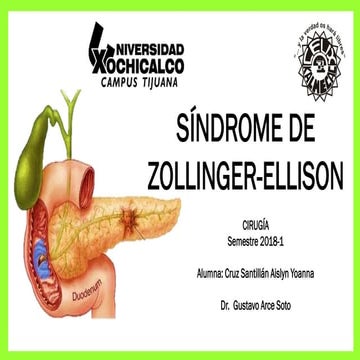 Sindrome de zollinger ellison | PDF