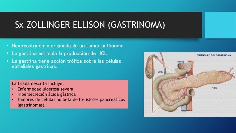 Sx zollinger ellison