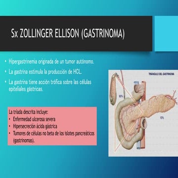 Sx zollinger ellison | PPTX