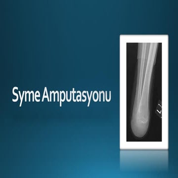 syme amputasyon.pdf described and fully explained | PPT