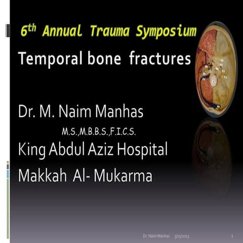 temporal bone fractures | PPTX