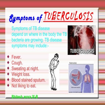 Symptoms of tuberculosis | ODP