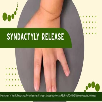 SYNDACTYLY RELEASE..pptx