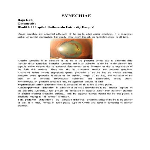 Synechia | DOCX