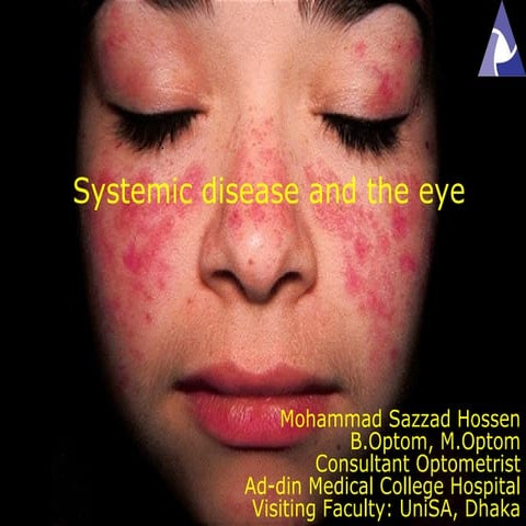 Systemic disease SR | PPT