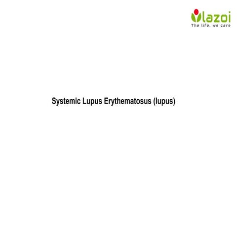 Systemic lupus erythematosus (lupus) | PPT