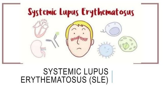 Understanding Autoimmune Disease Treatment - Plexus | PPT