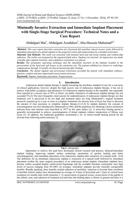 Immediate Placement and Provisionalization of Maxillary Posterior Single Implants | PDF