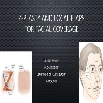 Facial flaps | PPTX