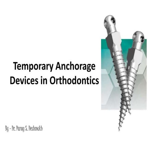 Temporary anchorage devices in orthodontics | PPTX
