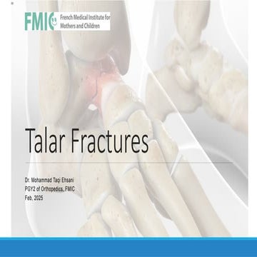 Talar Fractures (Fractures of Talus Bone).pptx