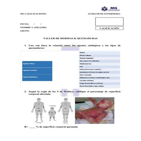 Taller grados de quemaduras y heridas y su tratamiento | PDF
