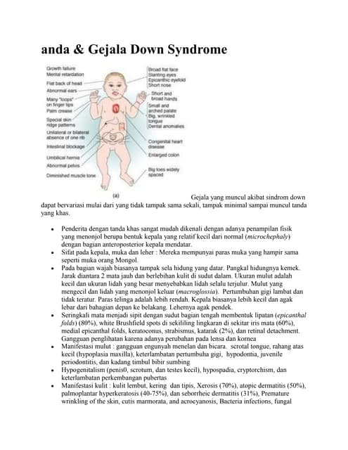 Down Sindrom PPT | PPTX