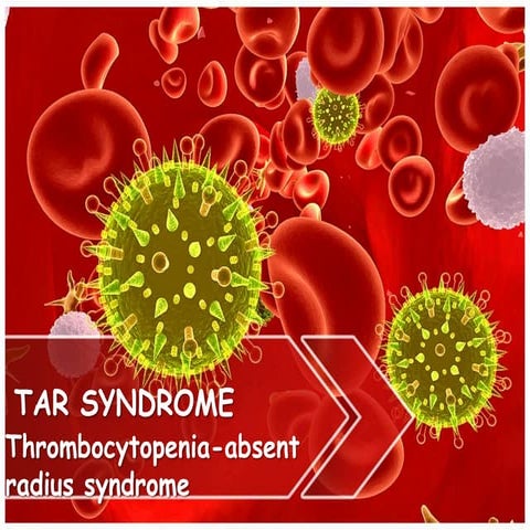 Tar syndrome group 6 | PPTX