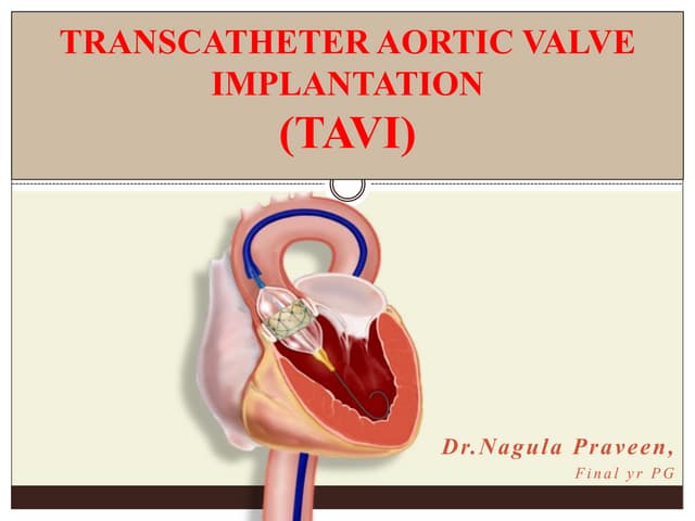 Transcatheter Aortic Valve Replacement (TAVR) | TAVR Procedure at ...